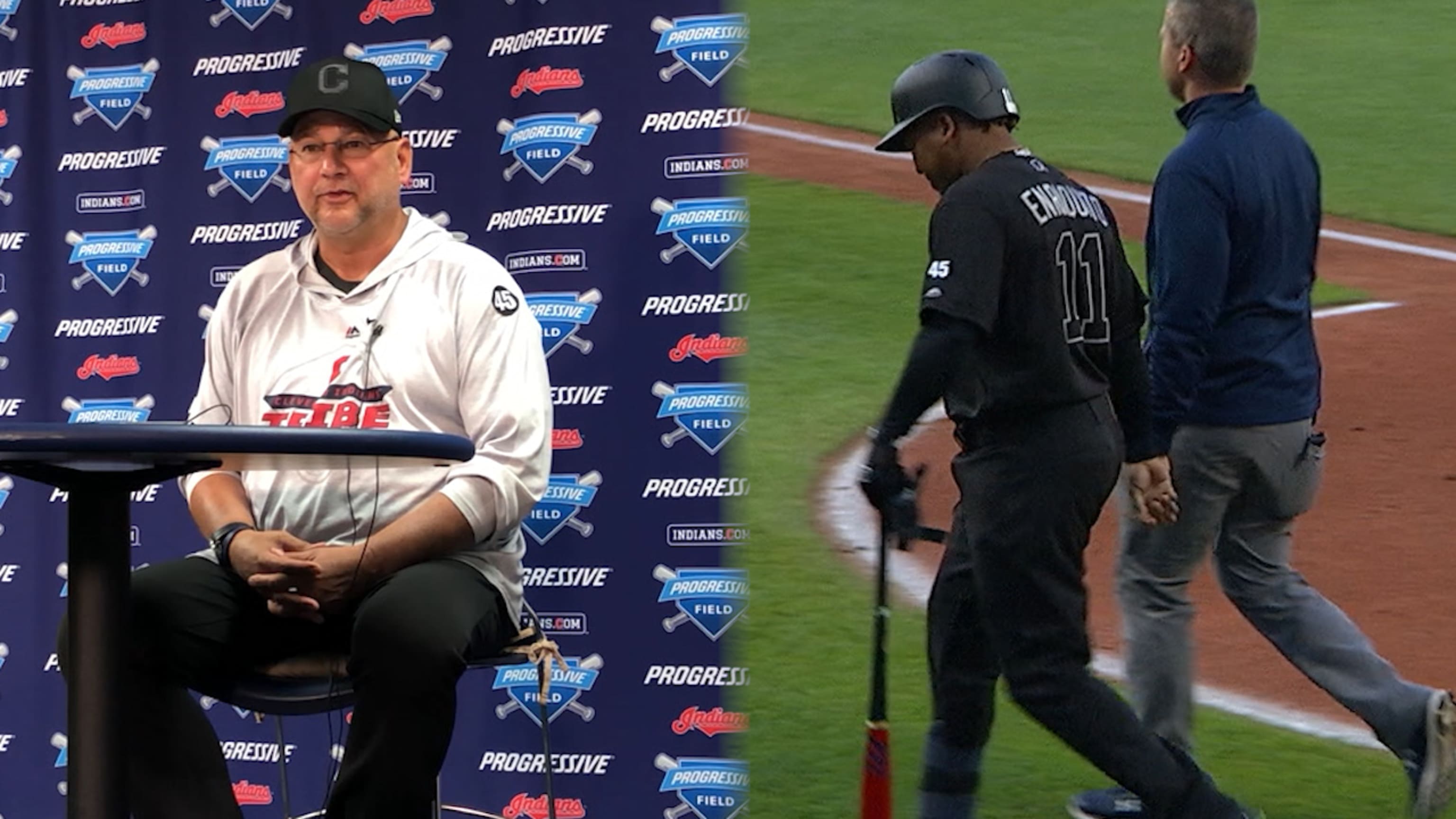 hamate bone baseball