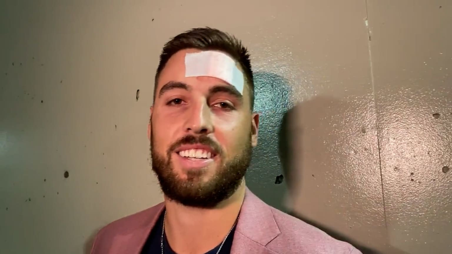 Daniel Castano on his head injury, how he feels | 07/28/2022 | MLB.com