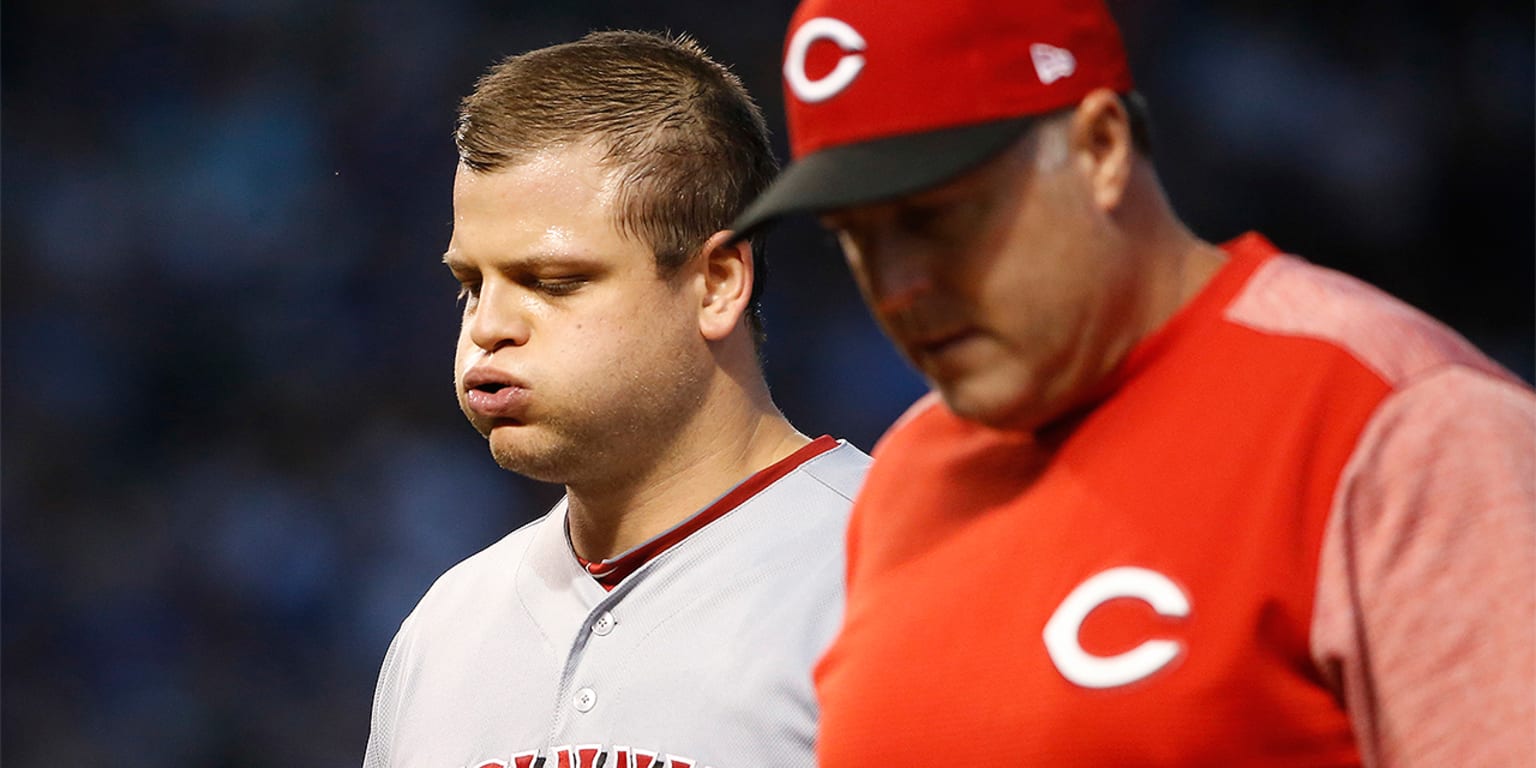 Reds' Devin Mesoraco on DL with foot injury