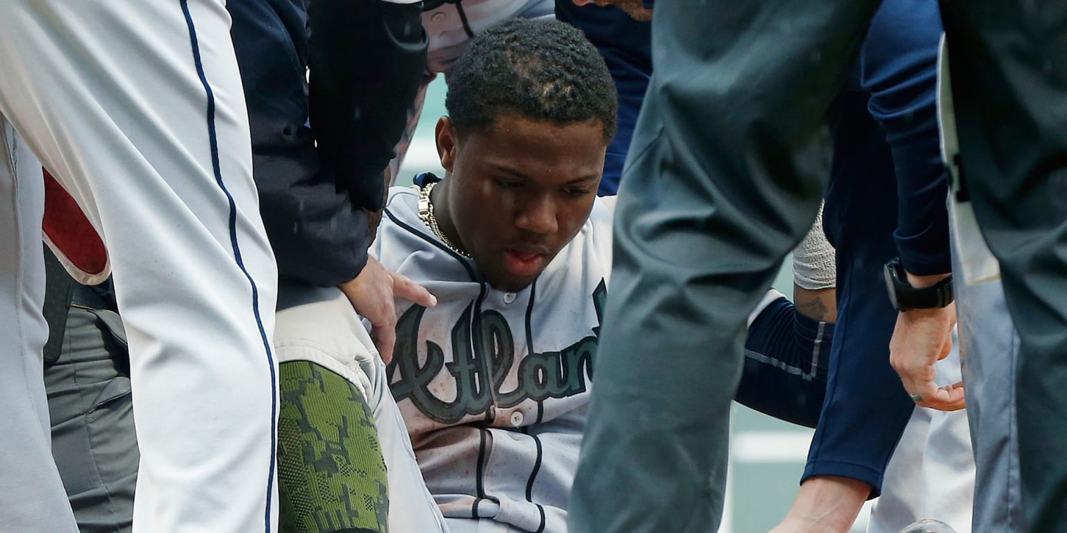 Ronald Acuna has ACL sprain, knee contusion