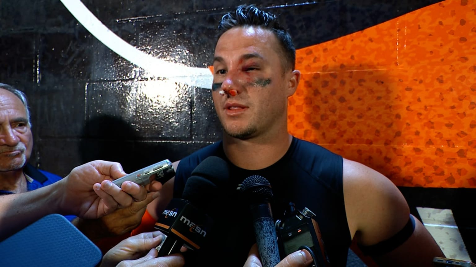 James Mccann On Getting Hit In The Face With Pitch 07292024 Baltimore Orioles 