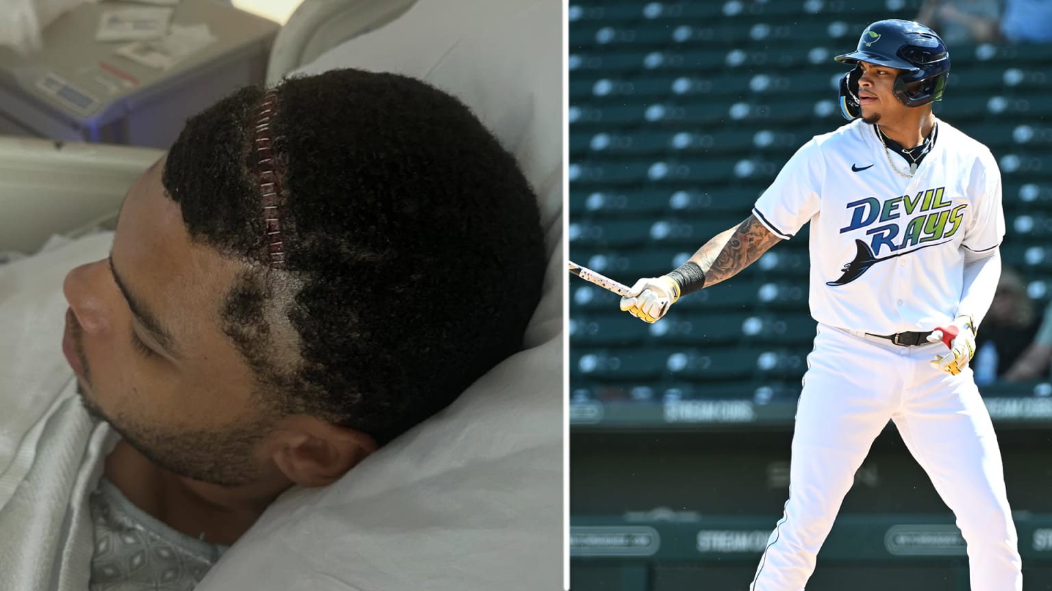 Prospecto de los Rays, Xavier Isaac, revela cirugía cerebral que le ...